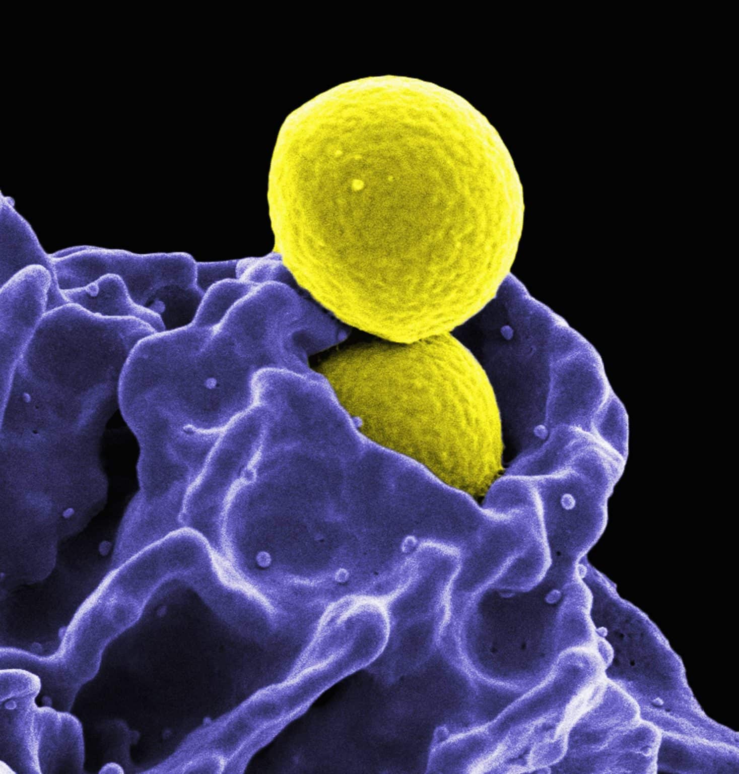 Phagocytosis of Bacteria in a Whole Blood Assay: The Influence of ...